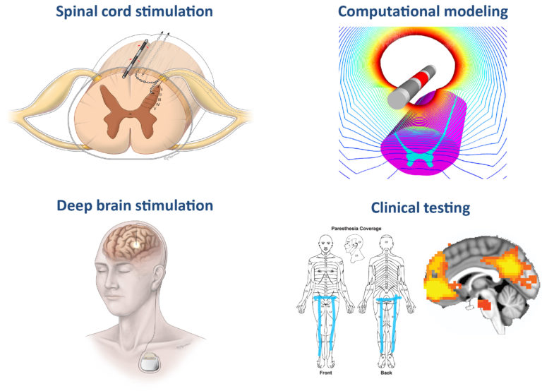 Research – Neuromodulation Laboratory